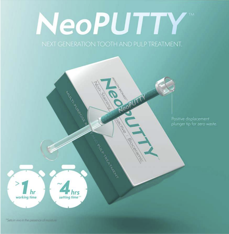 Avalon Biomed Neo Putty