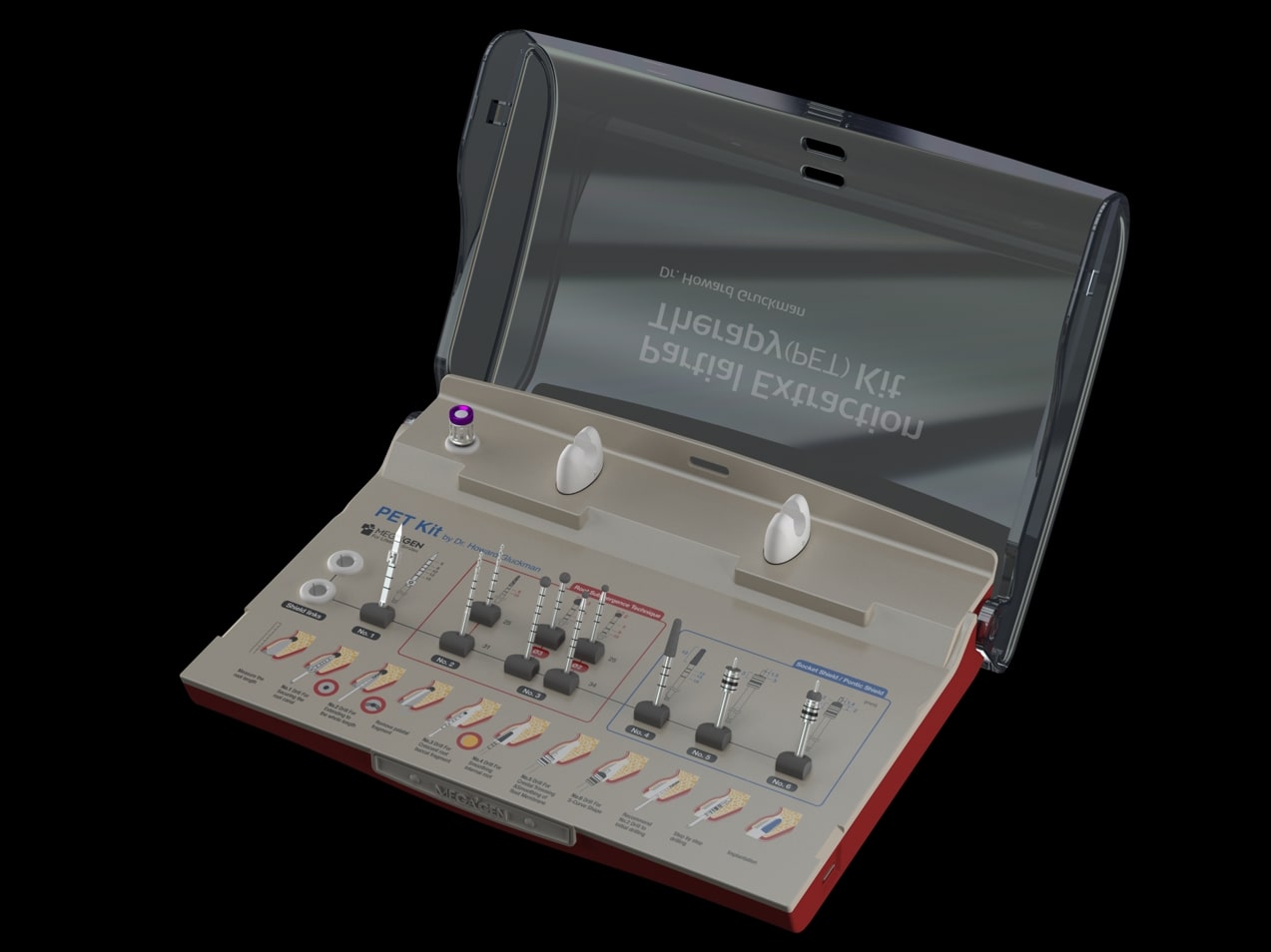 PET Partial Extraction Kit Gluckman & Components
